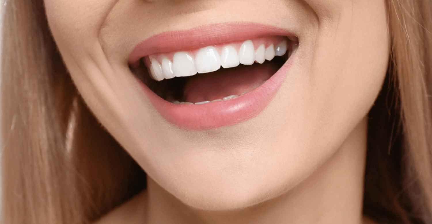 How much does a hollywood smile cost uk? - Vitrin Clinic